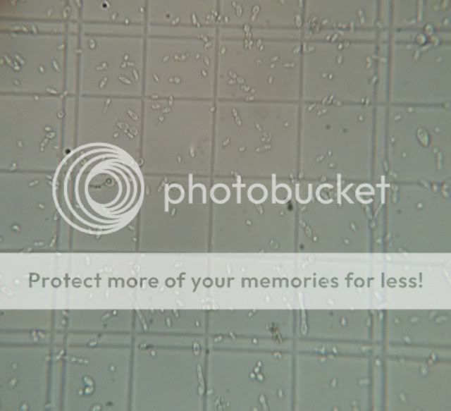 Microscopy pictures - Are those Brett? | Homebrew Talk - Beer, Wine ...